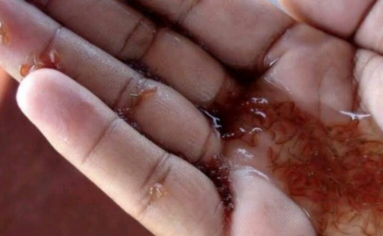 12 Pilihan Makanan Ikan Cupang untuk Nutrisi Terbaik! - Tokopedia Blog