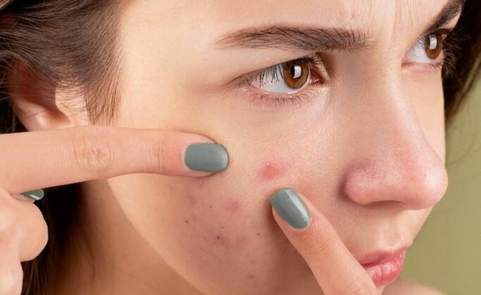 Apa Itu Clay Mask? Simak 13 Manfaat & Cara Penggunaannya!