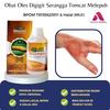 Jual Obat Oles Digigit Serangga Tomcat Kulit Melepuh Pengering Luka Qnc ...