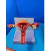 Jual Alat Peraga Model Anatomi Uterus And Ovaries Normal And ...