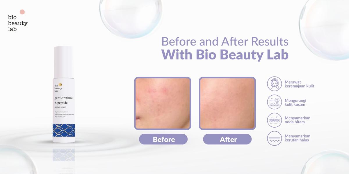 Bio Beauty Lab Official Shop - Produk Resmi & Terlengkap | Tokopedia