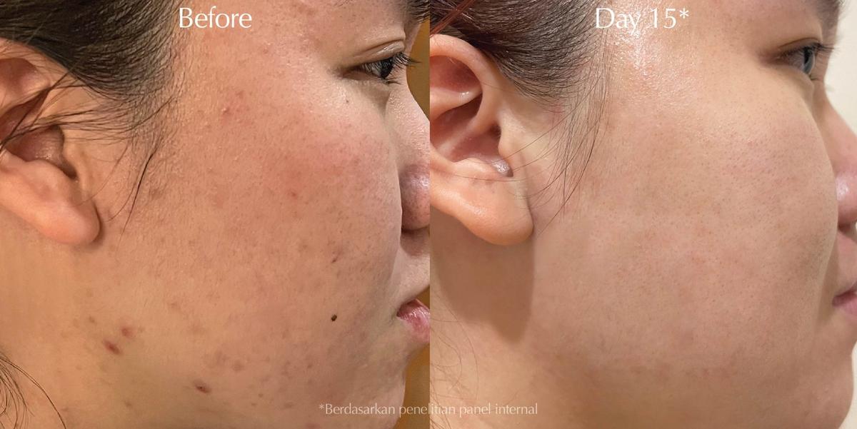 Polynia Indonesia - Produk Resmi & Terlengkap | GoPayLater Cicil 0% ...