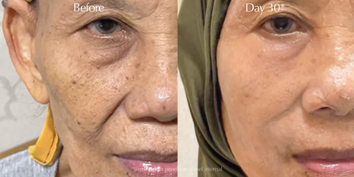 Polynia Indonesia - Produk Resmi & Terlengkap | GoPayLater Cicil 0% ...