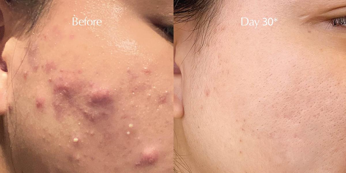 Polynia Indonesia - Produk Resmi & Terlengkap | GoPayLater Cicil 0% ...