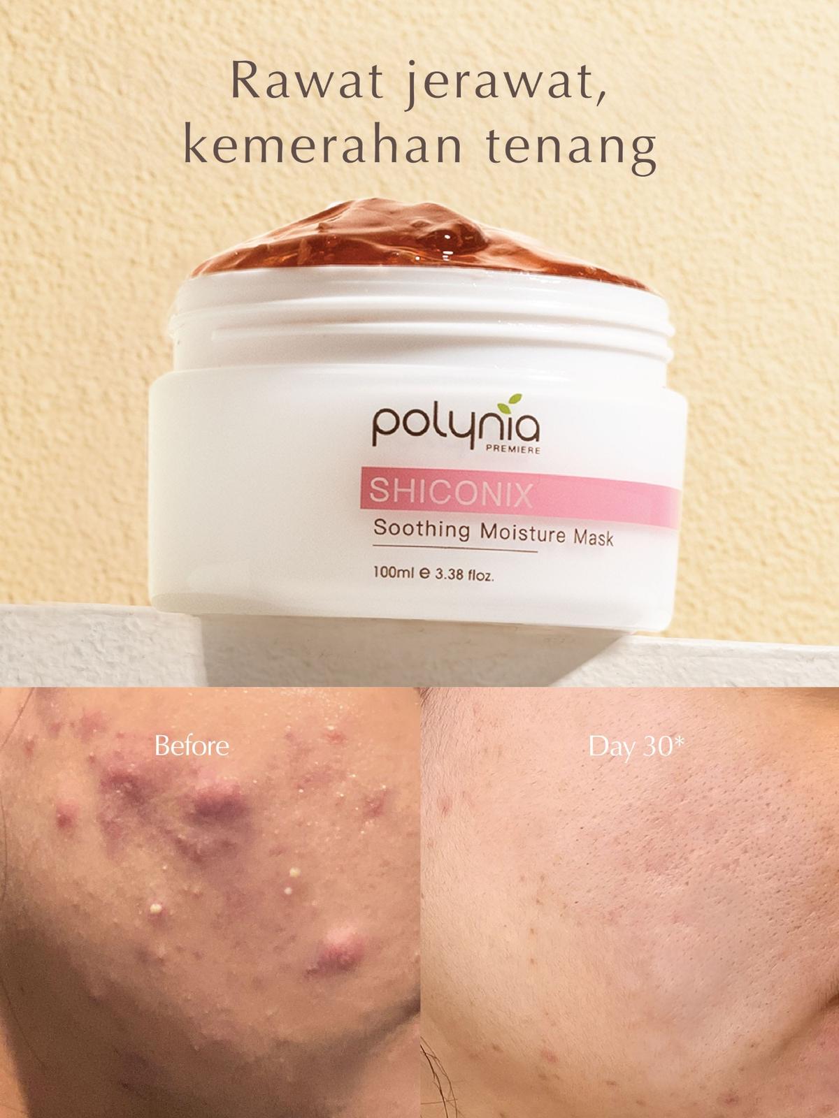 Polynia Indonesia - Produk Resmi & Terlengkap | GoPayLater Cicil 0% ...