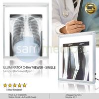 Jual X Ray Viewer Terlengkap - Harga Murah Mei 2025