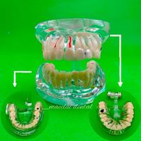 Jual Phantom Gigi Terlengkap - Harga Murah Februari 2023