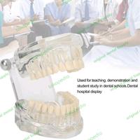 Jual Phantom Gigi Terlengkap - Harga Murah Juni 2024