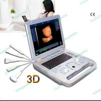 Jual Usg Portable Murah - Harga Terbaru Mei 2025