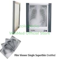 Jual X Ray Viewer Terlengkap - Harga Murah Oktober 2025