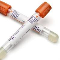 Jual Tabung Vacutainer Murah - Harga Terbaru Maret 2025