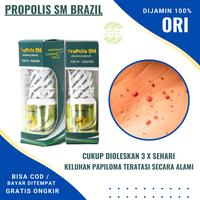 Jual Obat Papiloma Murah - Harga Terbaru Mei 2024