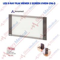 Jual X Ray Viewer Terlengkap - Harga Murah Februari 2025