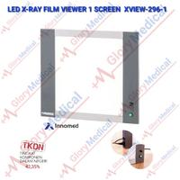 Jual X Ray Viewer Terlengkap - Harga Murah Maret 2025