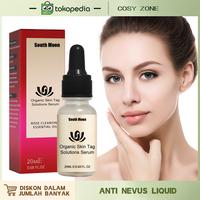 Review South Moon Organic Skin Tag Solutions Serum 20g Obat Penghilang ...