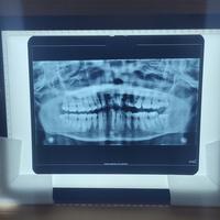 Jual X Ray Viewer Terlengkap - Harga Murah Maret 2025