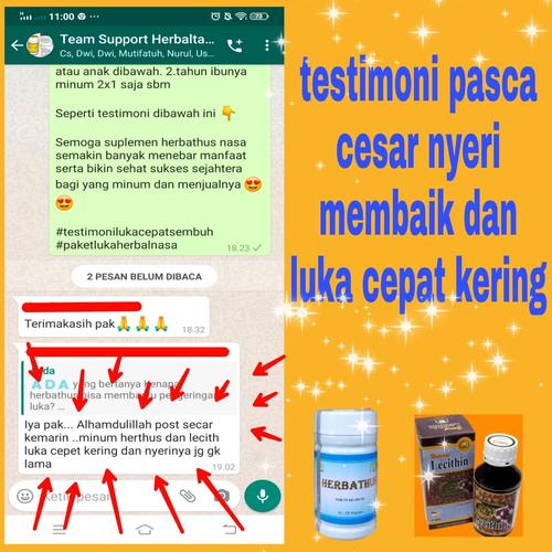 Jual Herbal Nasa Pasca Operasi Secar - Jakarta Barat - dewi astra nasa ...