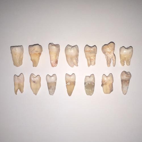 Jual Gigi asli posterior untuk praktikum (gigi premolar / gigi molar ...