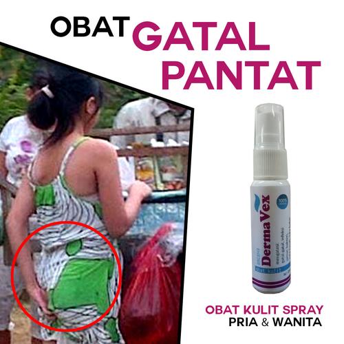 Jual Obat Gatal Pantat, Punggung, Kaki. AMPUH. MANJUR. Dermavex Spray ...