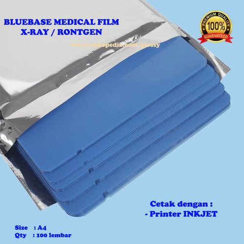 Jual MEDICAL FILM / RONTGEN / X-RAY - INKJET - Jakarta Pusat - GLOSSY ...