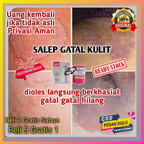 Jual Salep Obat Gatal Selangkangan Gatel Jamur Eksim Jerawat Dijamin ...