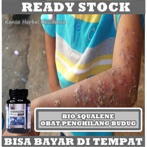 Jual Obat Scabies Manusia, Gatal Scabies Manusia, Penghilang Bekas ...
