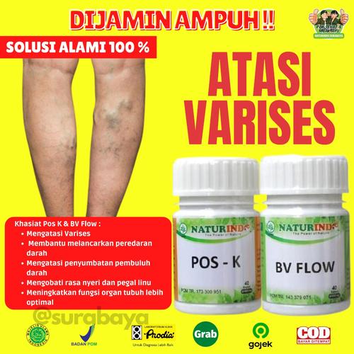 Jual OBAT PENGHILANG VARISES OBAT KAKI KELUAR OTOT VARISES PALING AMPUH ...