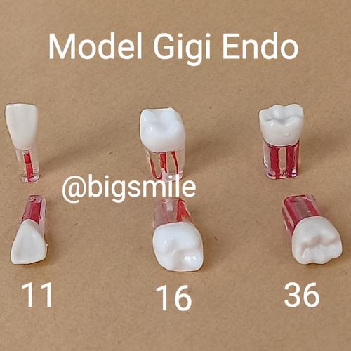 Jual Model Gigi Endo Endodontics Model Gigi Saluran Akar Root Canal ...