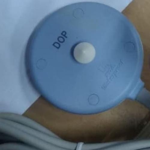 Jual probe CTG bistos I model DOP - Jakarta Utara - skmedica | Tokopedia