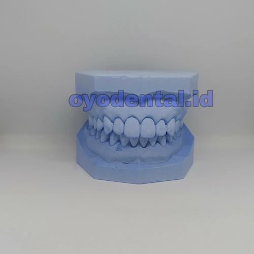 Jual dental model study gips / model gigi gipsum / model study gypsum ...