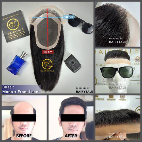 Jual Toupee/tutup botak pria, natural 20cm, luas 22x15,Netting: mono ...