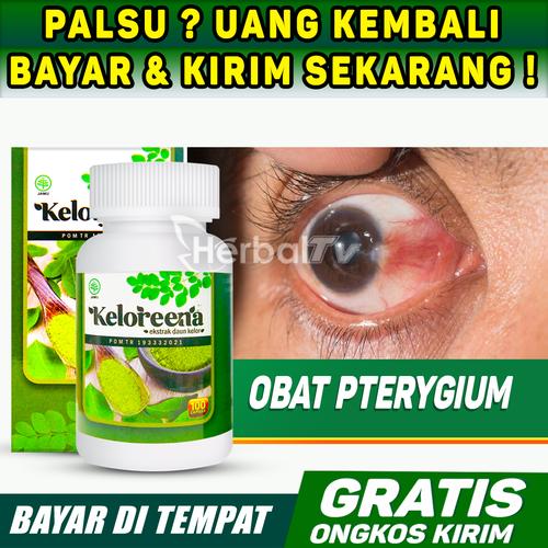 Jual Obat Mata Berlemak dan Lamad Pterigium Pterygium Ekstrak Daun ...