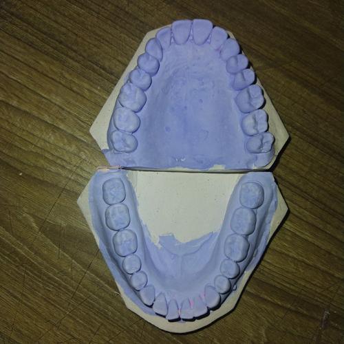 Jual model gigi, phantom, custem model gigi. white/blue/yellow/brown ...