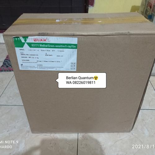 Jual Film Rontgen, X Ray, Radiologi,, ukuran 35 x 35cm - Kota Bekasi ...
