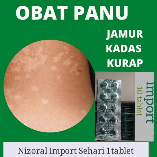 Jual nizoral tablet - Kab. Aceh Timur - Faqath Serba | Tokopedia