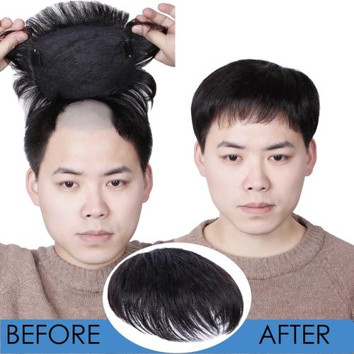 Jual TOUPEE / PENUTUP BOTAK COWOK PRIA LAKI - LAKI 012 RSW REAL HUMAN ...