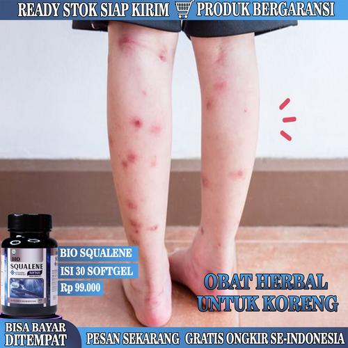 Jual Obat Penghilang Koreng Di Kaki - Korengan, Koreng Gatal, Obat ...