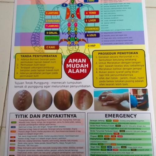 Jual poster totok punggung lengkap - pin aja - Kab. Bekasi - rumah ...