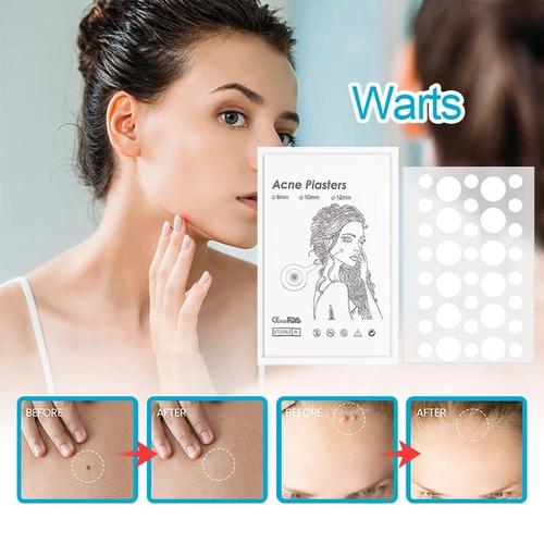 Jual Acne Plasters Patch Pimple Stiker Penutup Jerawat - Acne Plaster ...
