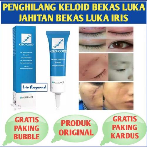 Jual ORIGINAL PENGHILANG KELOID BEKAS LUKA JAHITAN BEKAS LUKA IRIS ...