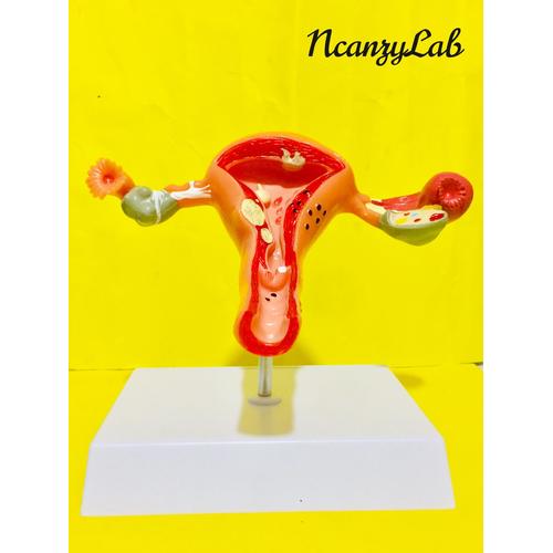 Jual Alat Peraga Anatomi Rahim /Uterus and Ovaries ( Normal ...