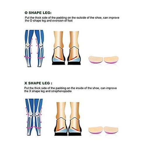 Jual Corrector Kaki O & X / Korektor Kaki O & X / Insole Kaki O & X ...