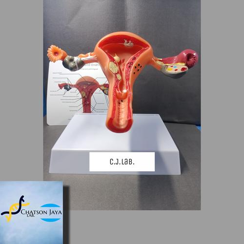 Jual Alat Peraga Uterus dan Ovarium Normal dan Patologi-Manekin Rahim ...