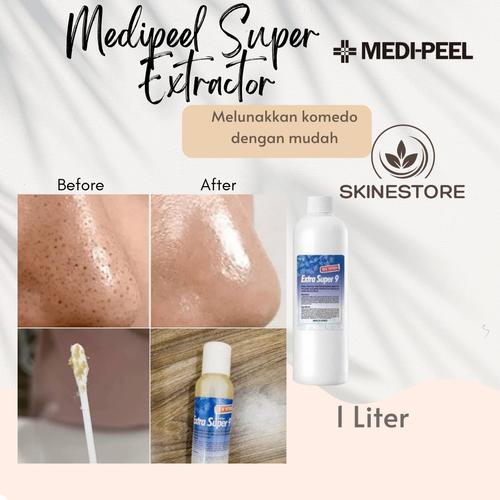 Jual MEDIPEEL SUPER EXTRACTOR 1 LITER ORIGINAL 100% - Dengan Label ...