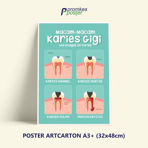 Jual Poster Kesehatan Macam-macam karies gigi - Kab. Tangerang ...