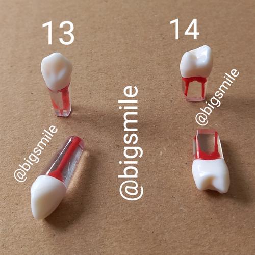 Jual Gigi Endo Molar Premolar Incisor Canine Model Endodontic Root ...