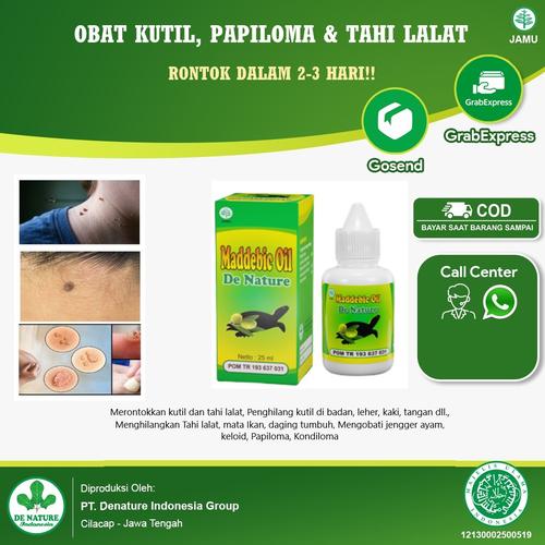 Jual Obat Kutil Kelamin Daging Tumbuh Bintik di Kemaluan dipenis Pria ...