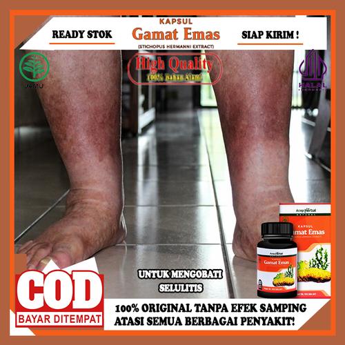 Jual Obat Selulitis,Infeksi Kulit Selulitis,Kulit Kemerahan Dan Bengkak ...