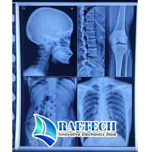 Jual Cetak Film Radiologi Medical Rontgen X-RAY A4 - Putih - Kota ...