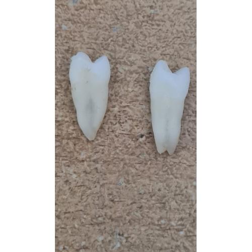 Jual gigi premolar/ gigi asli untuk praktikum - Kota Bandung - Hayat ...
